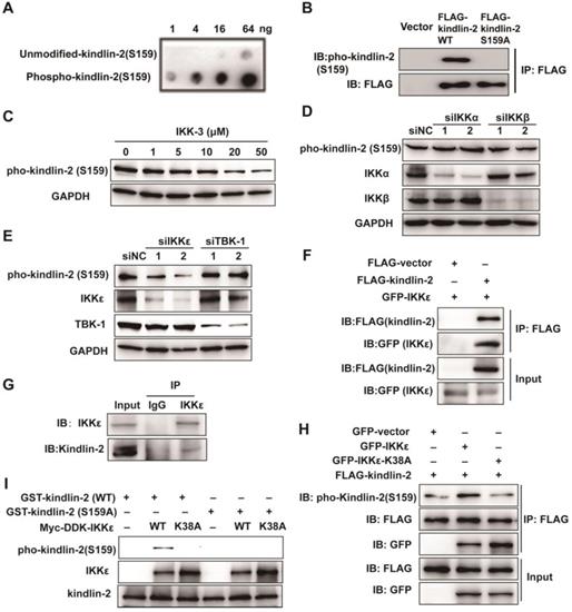 IKKε phosphorylates kindlin-2 to induce invadopodia formation and ...