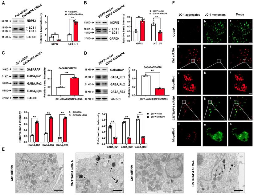 CNTNAP4 deficiency in dopaminergic neurons initiates parkinsonian ...