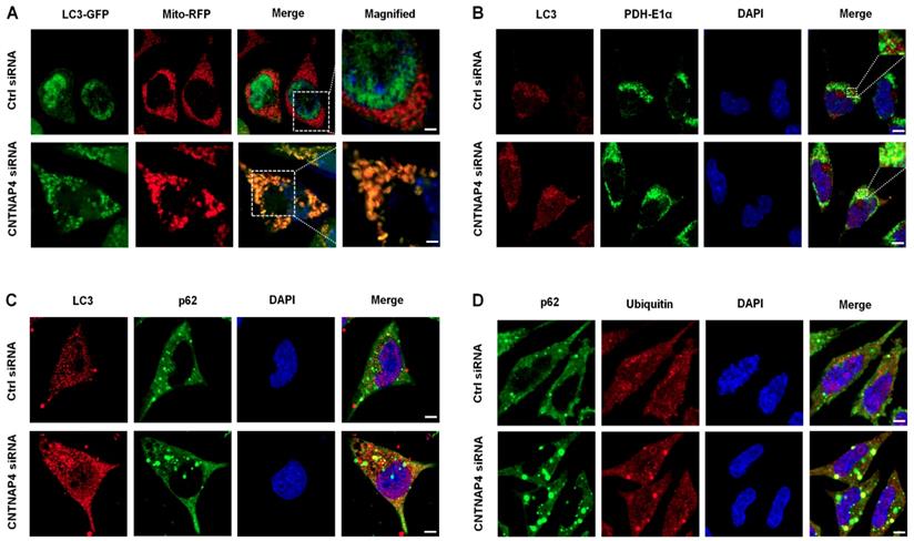 CNTNAP4 deficiency in dopaminergic neurons initiates parkinsonian ...