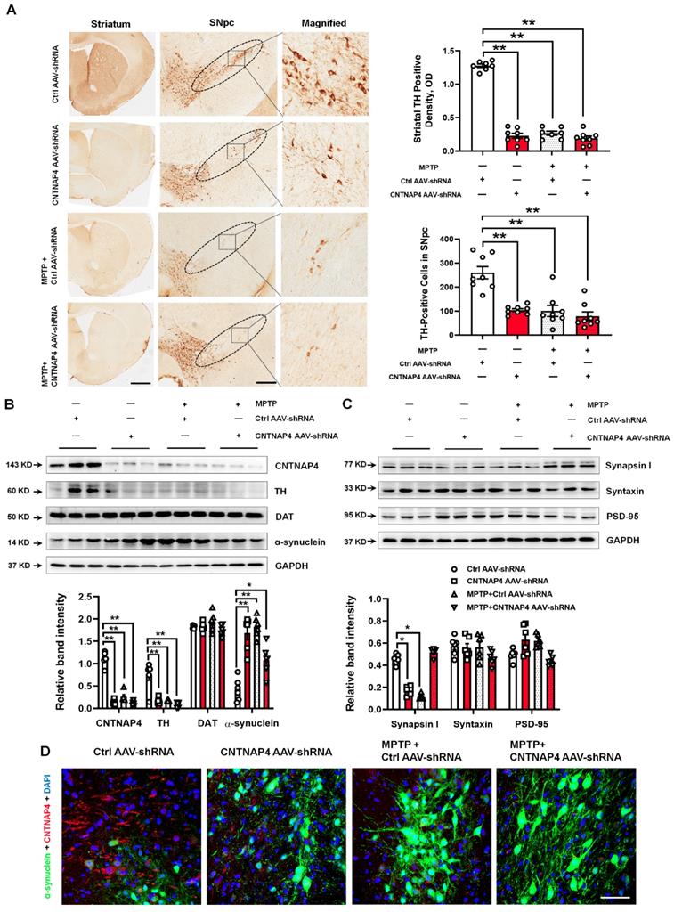 CNTNAP4 deficiency in dopaminergic neurons initiates parkinsonian ...