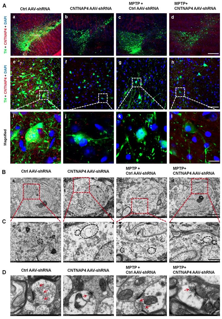 CNTNAP4 deficiency in dopaminergic neurons initiates parkinsonian ...