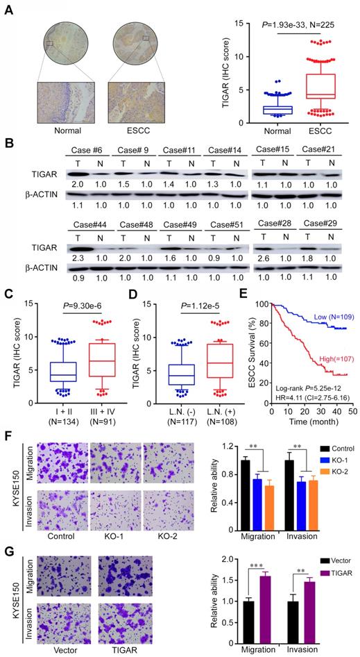 Metabolic remodeling by TIGAR overexpression is a therapeutic target in ...