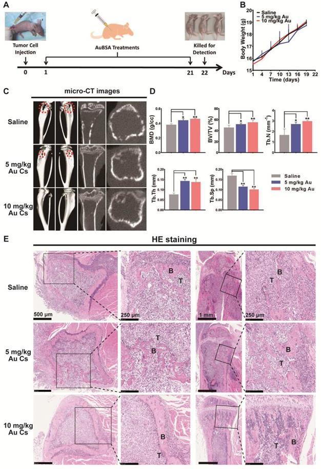 Gold clusters prevent breast cancer bone metastasis by suppressing ...