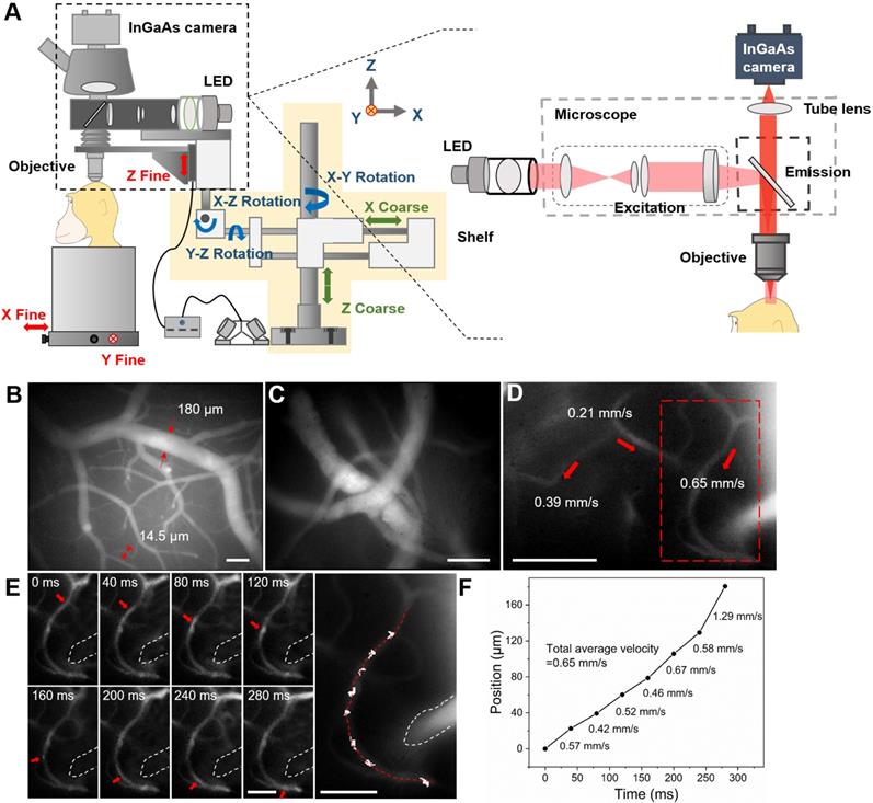 NIR-II fluorescence microscopic imaging of cortical vasculature in non ...