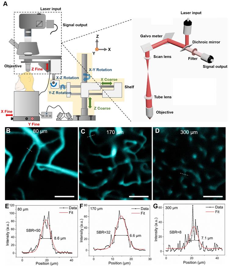 NIR-II fluorescence microscopic imaging of cortical vasculature in non ...