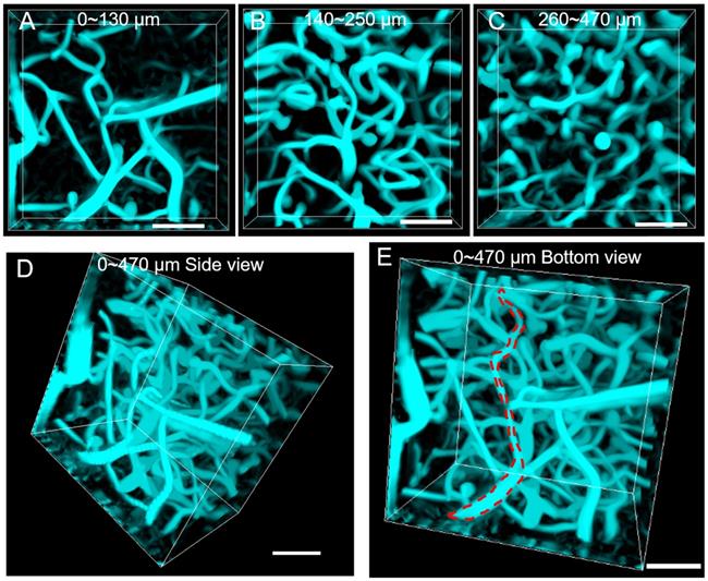 NIR-II fluorescence microscopic imaging of cortical vasculature in non ...