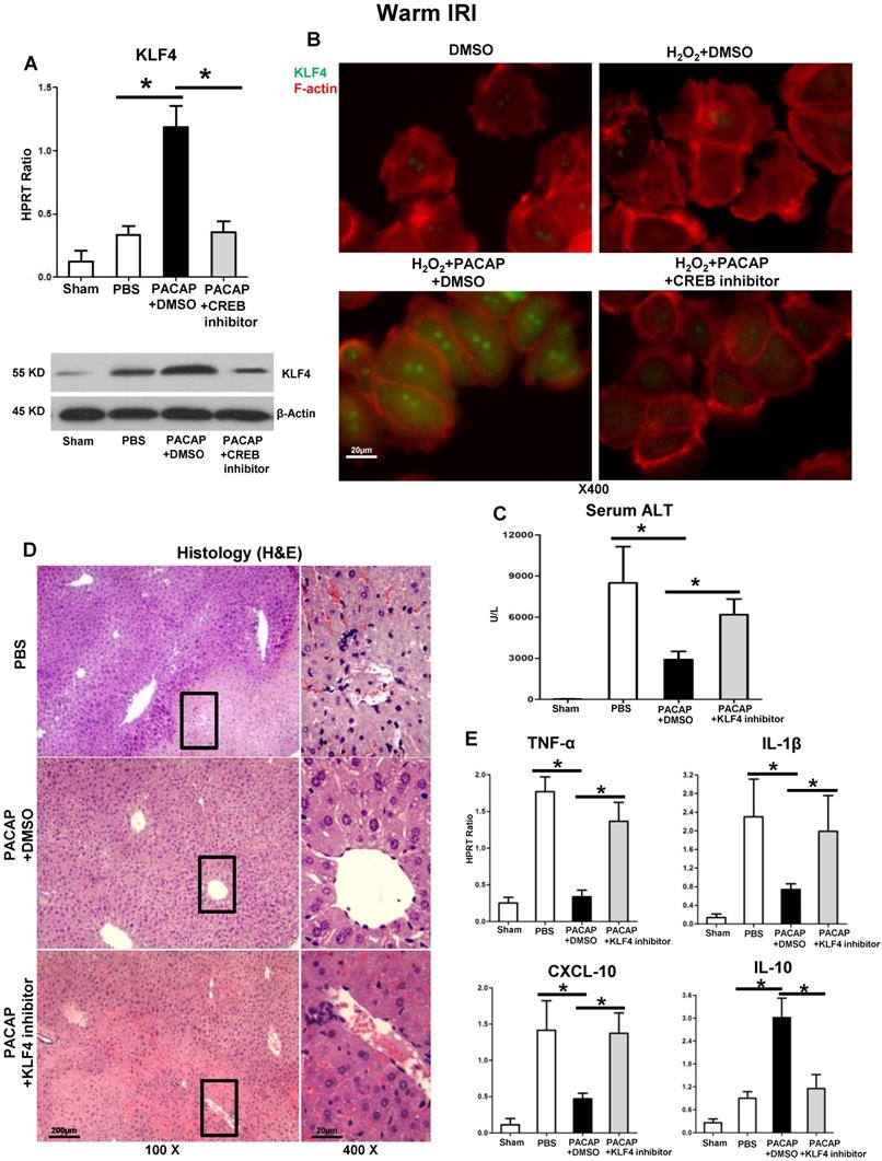 PACAP neuropeptide promotes Hepatocellular Protection via CREB-KLF4 ...