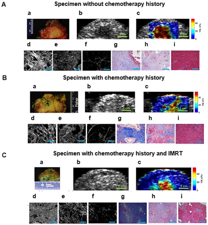 Noninvasive Young's modulus visualization of fibrosis progression and ...