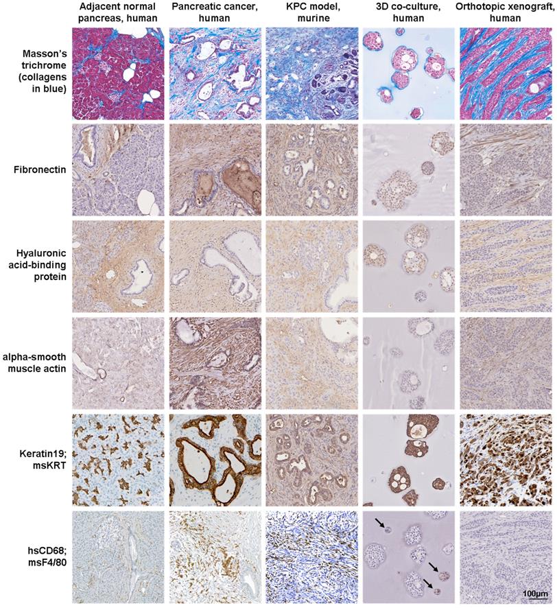 3D approaches to model the tumor microenvironment of pancreatic cancer