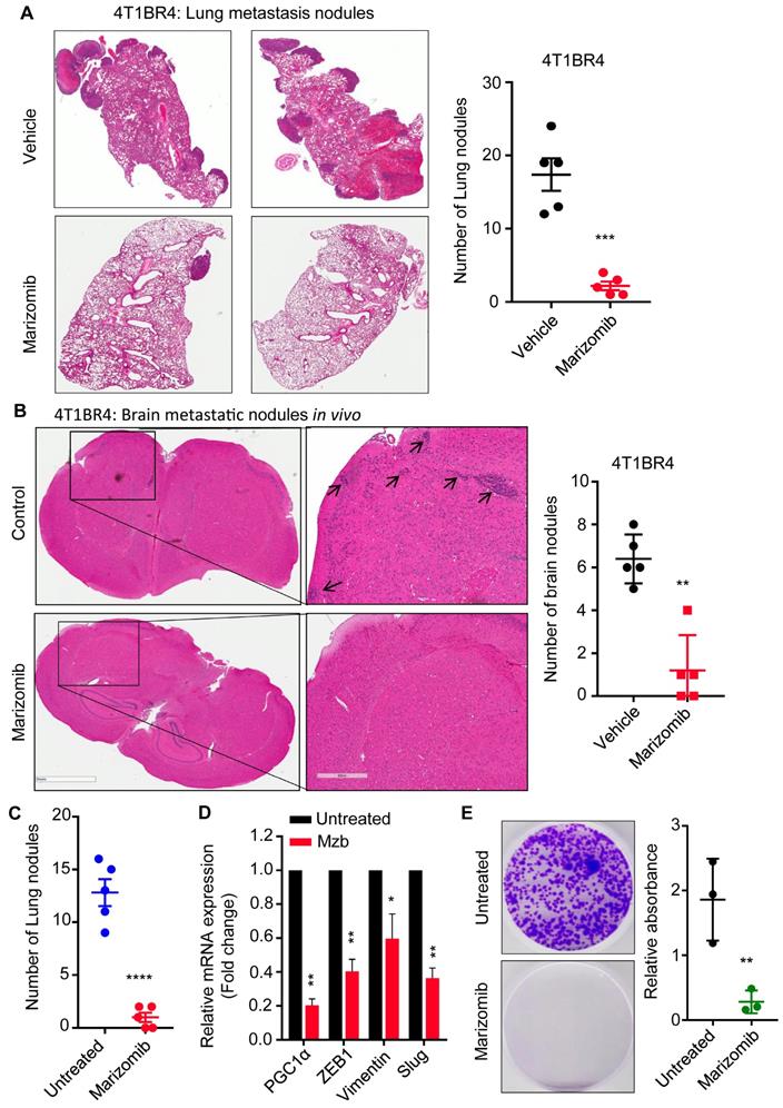 Marizomib suppresses triple-negative breast cancer via proteasome and ...