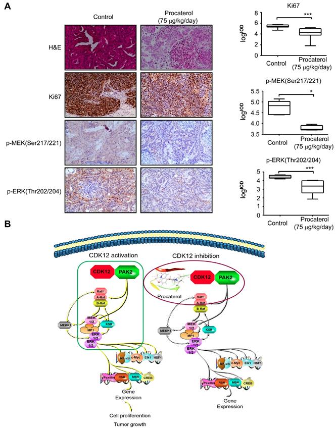 CDK12 and PAK2 as novel therapeutic targets for human gastric cancer