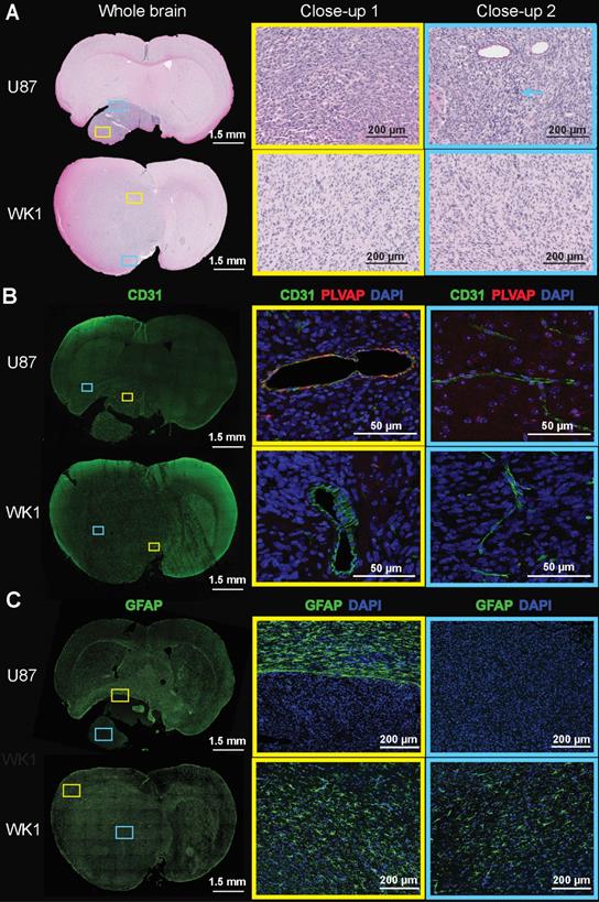 Comparative study of preclinical mouse models of high-grade glioma for ...