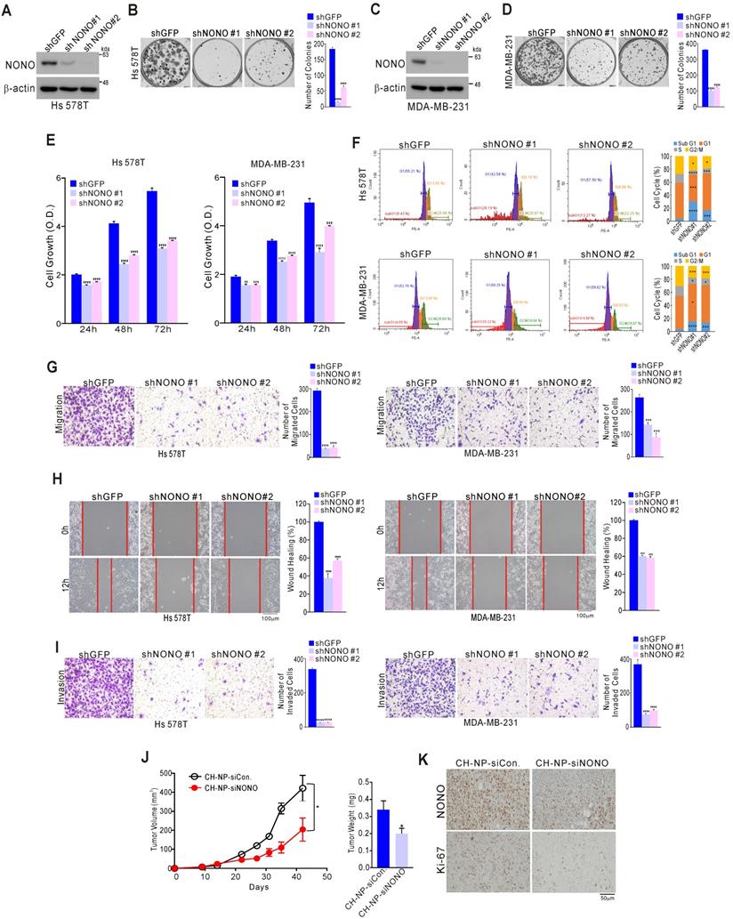 RNA-binding protein NONO contributes to cancer cell growth and confers ...