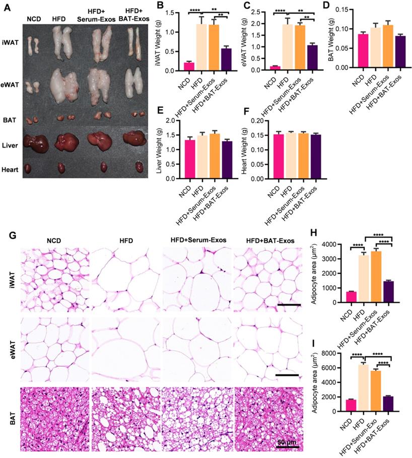 Brown adipose tissue-derived exosomes mitigate the metabolic syndrome ...