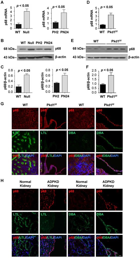 RNA helicase p68 inhibits the transcription and post-transcription of ...