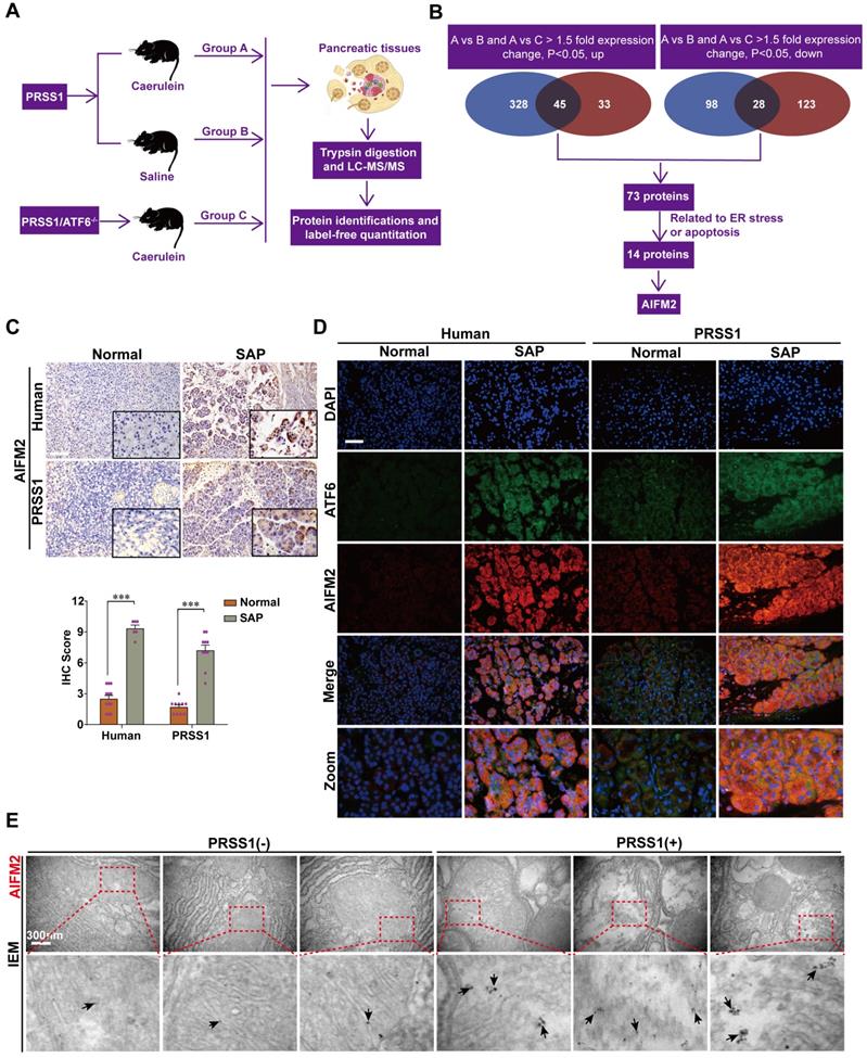 ATF6 aggravates acinar cell apoptosis and injury by regulating p53 ...