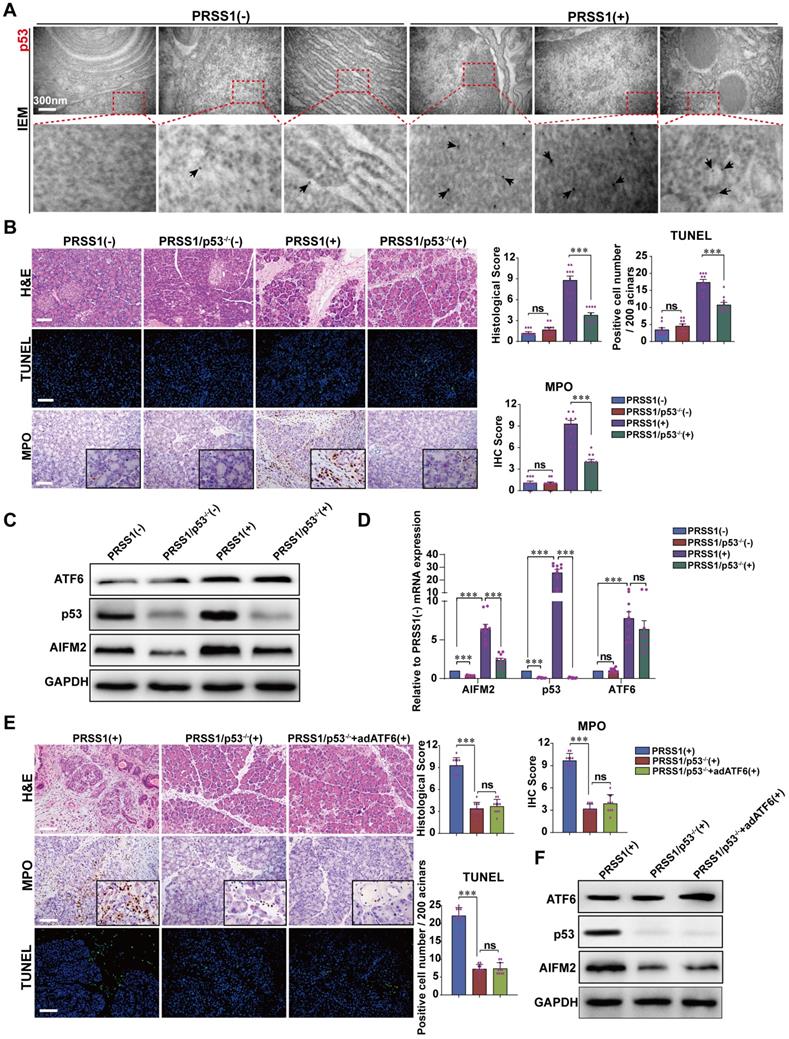 ATF6 aggravates acinar cell apoptosis and injury by regulating p53 ...