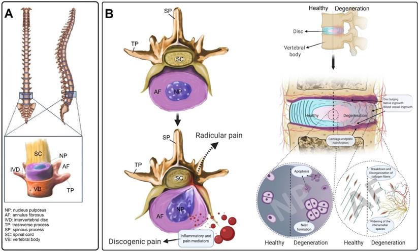 Small molecule-based treatment approaches for intervertebral disc ...