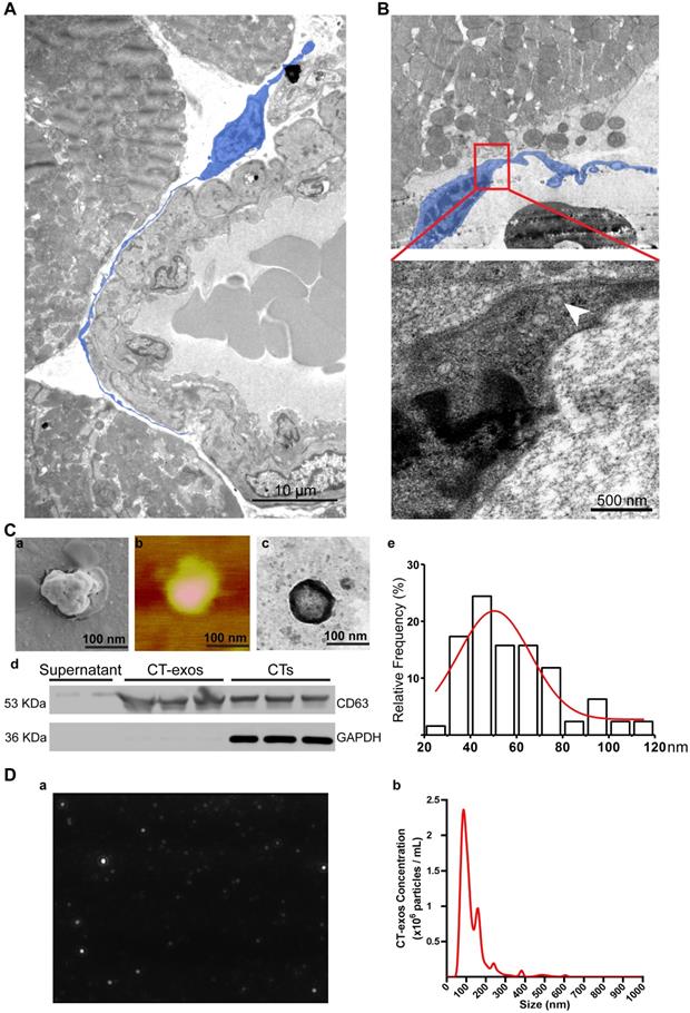 Cardiac telocytes inhibit cardiac microvascular endothelial cell ...