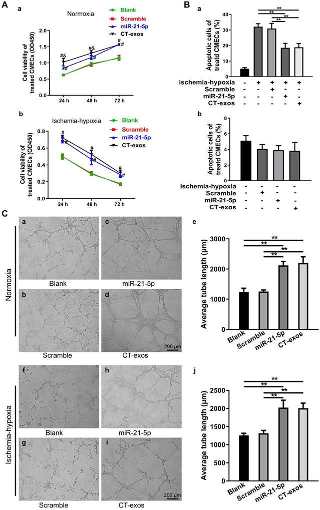Cardiac telocytes inhibit cardiac microvascular endothelial cell ...