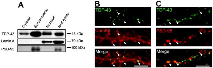 TDP-43 proteinopathy impairs mRNP granule mediated postsynaptic ...