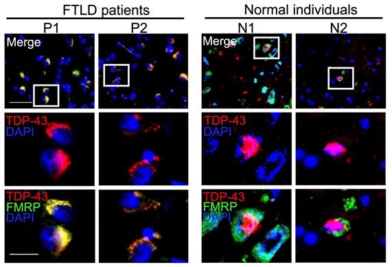 TDP-43 proteinopathy impairs mRNP granule mediated postsynaptic ...