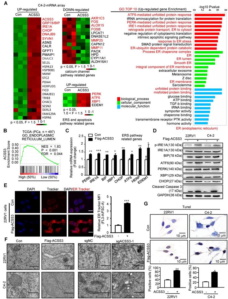 ACSS3 represses prostate cancer progression through downregulating ...
