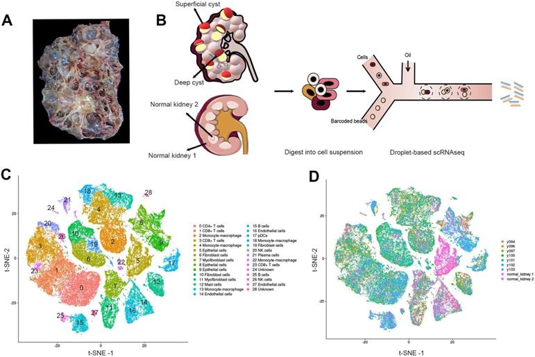 Heterogeneity of cell composition and origin identified by single-cell ...