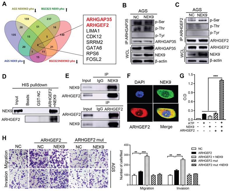 NEK9, a novel effector of IL-6/STAT3, regulates metastasis of gastric ...