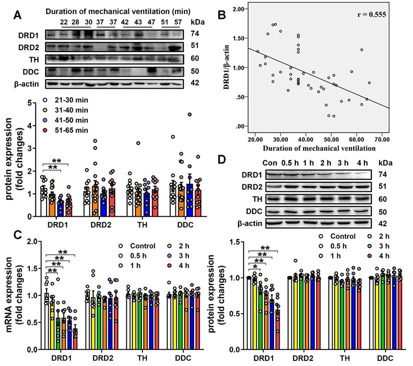 DRD1 downregulation contributes to mechanical stretch-induced lung ...