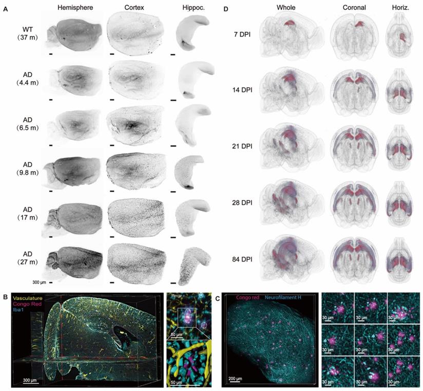 Optical Tissue Clearing: Illuminating Brain Function and Dysfunction