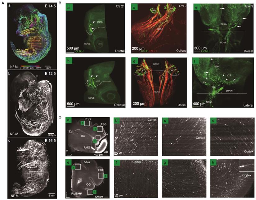 Optical Tissue Clearing: Illuminating Brain Function and Dysfunction