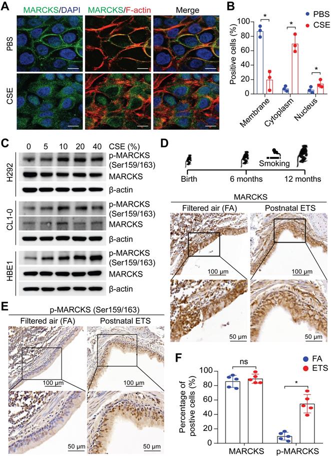 MARCKS cooperates with NKAP to activate NF-kB signaling in smoke ...