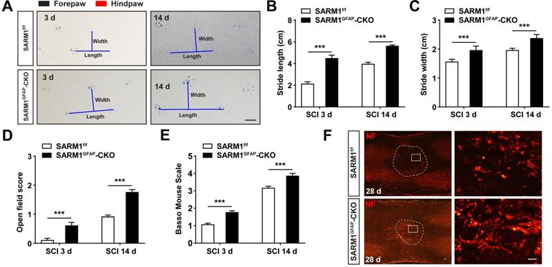 SARM1 promotes neuroinflammation and inhibits neural regeneration after ...