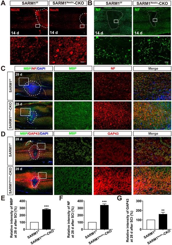 SARM1 promotes neuroinflammation and inhibits neural regeneration after ...