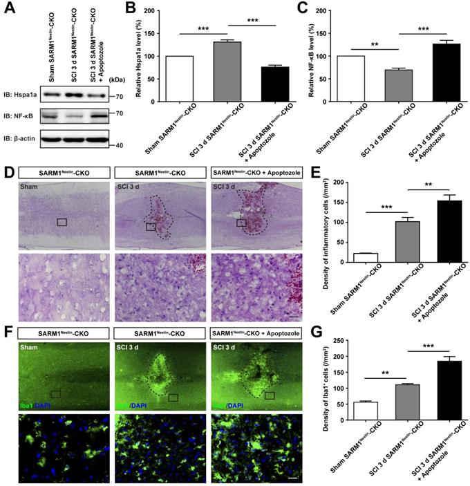 SARM1 promotes neuroinflammation and inhibits neural regeneration after ...