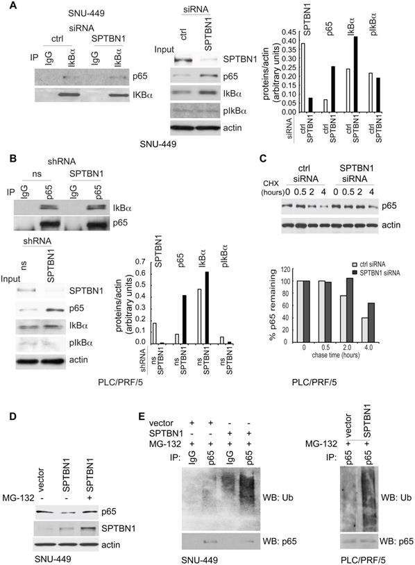 SPTBN1 inhibits inflammatory responses and hepatocarcinogenesis via the ...