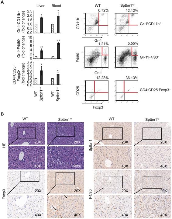 SPTBN1 inhibits inflammatory responses and hepatocarcinogenesis via the ...