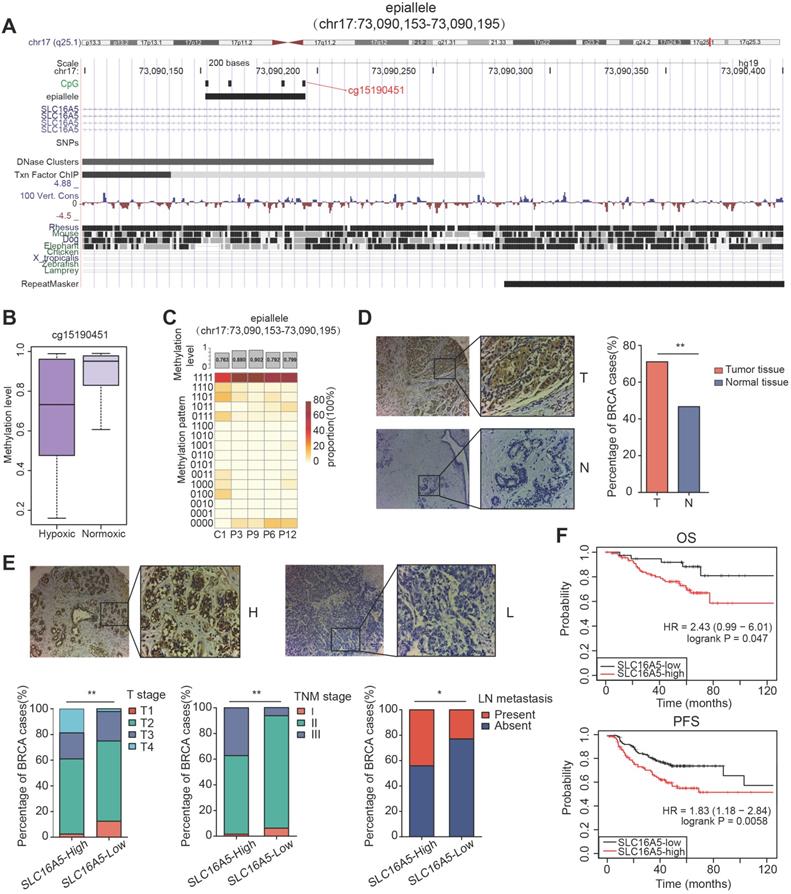 Intratumor heterogeneity of breast cancer detected by epialleles shows ...