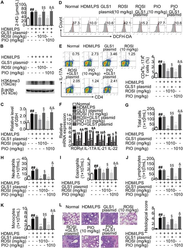 The role of GLS1-mediated glutaminolysis/2-HG/H3K4me3 and GSH/ROS ...