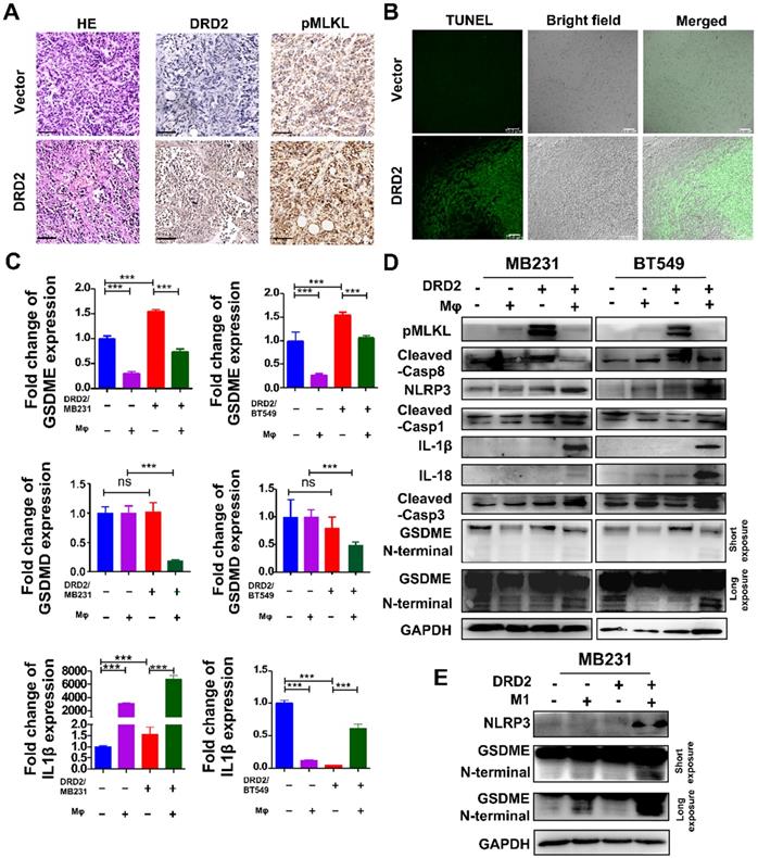 Tumor suppressor DRD2 facilitates M1 macrophages and restricts NF-κB ...