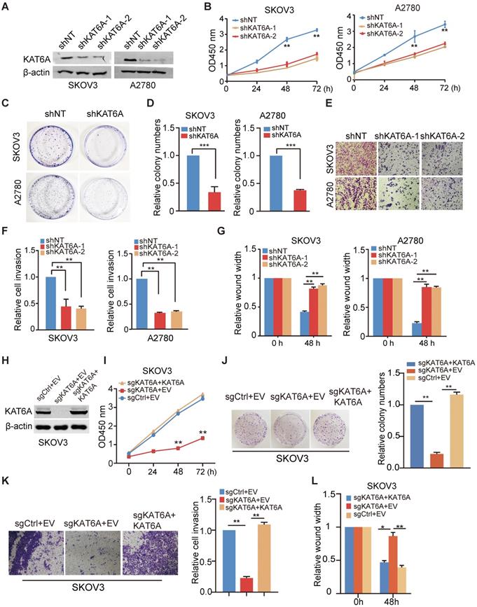 KAT6A, a novel regulator of β-catenin, promotes tumorigenicity and ...