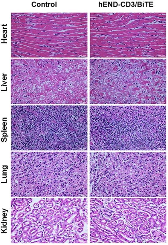 Human endoglin-CD3 bispecific T cell engager antibody induces anti ...
