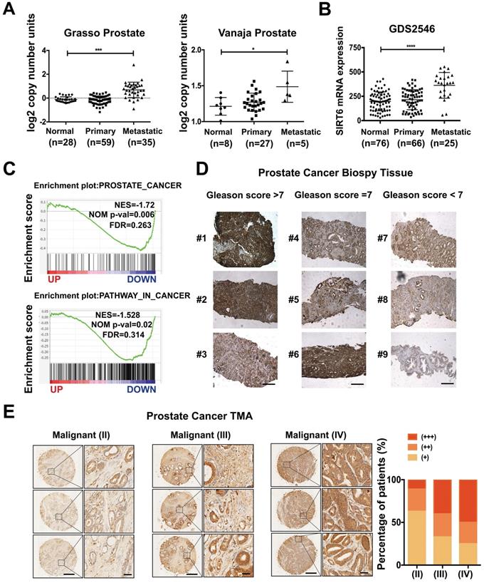 Targeted inhibition of SIRT6 via engineered exosomes impairs ...