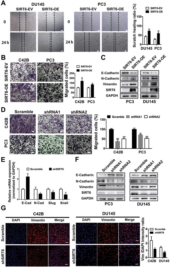 Targeted inhibition of SIRT6 via engineered exosomes impairs ...