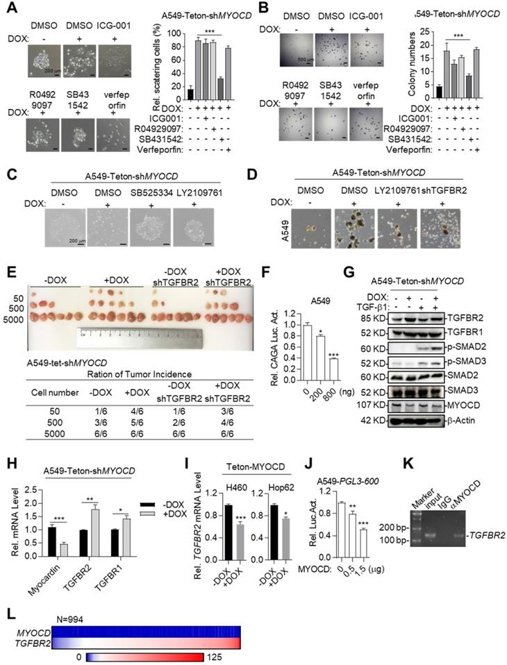 Targeting hyperactive TGFBR2 for treating MYOCD deficient lung cancer