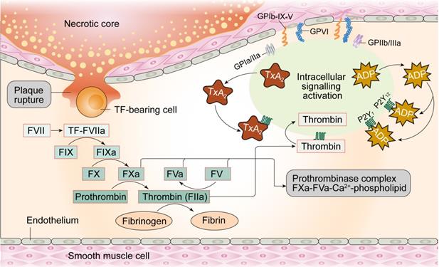 Coronary microvascular injury in myocardial infarction: perception and ...