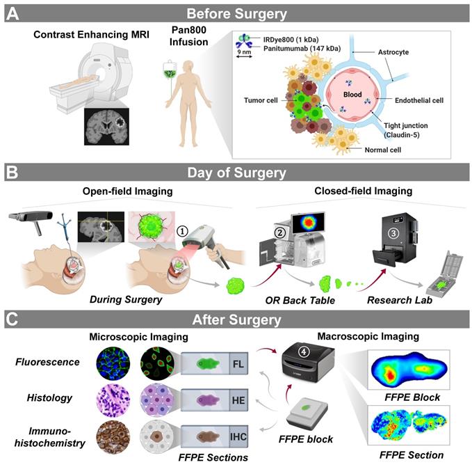 EGFR-targeted intraoperative fluorescence imaging detects high-grade ...