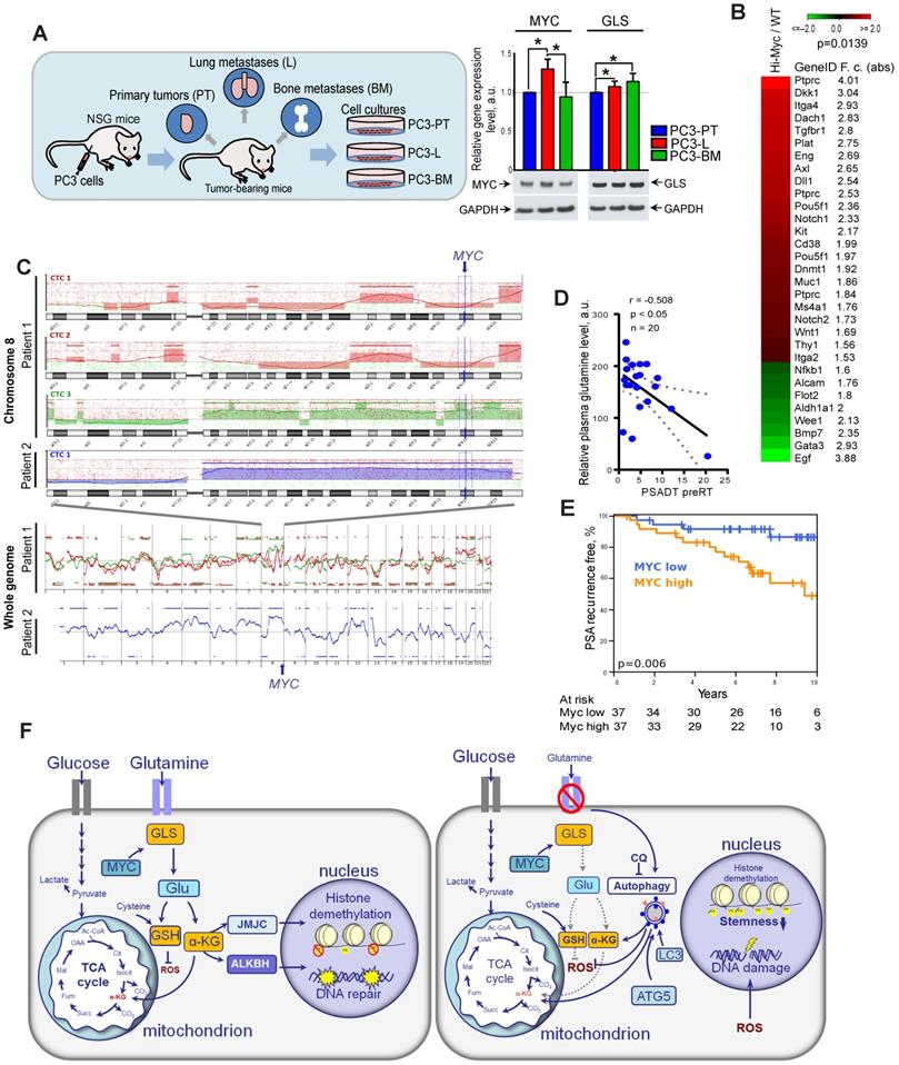 GLS-driven glutamine catabolism contributes to prostate cancer ...