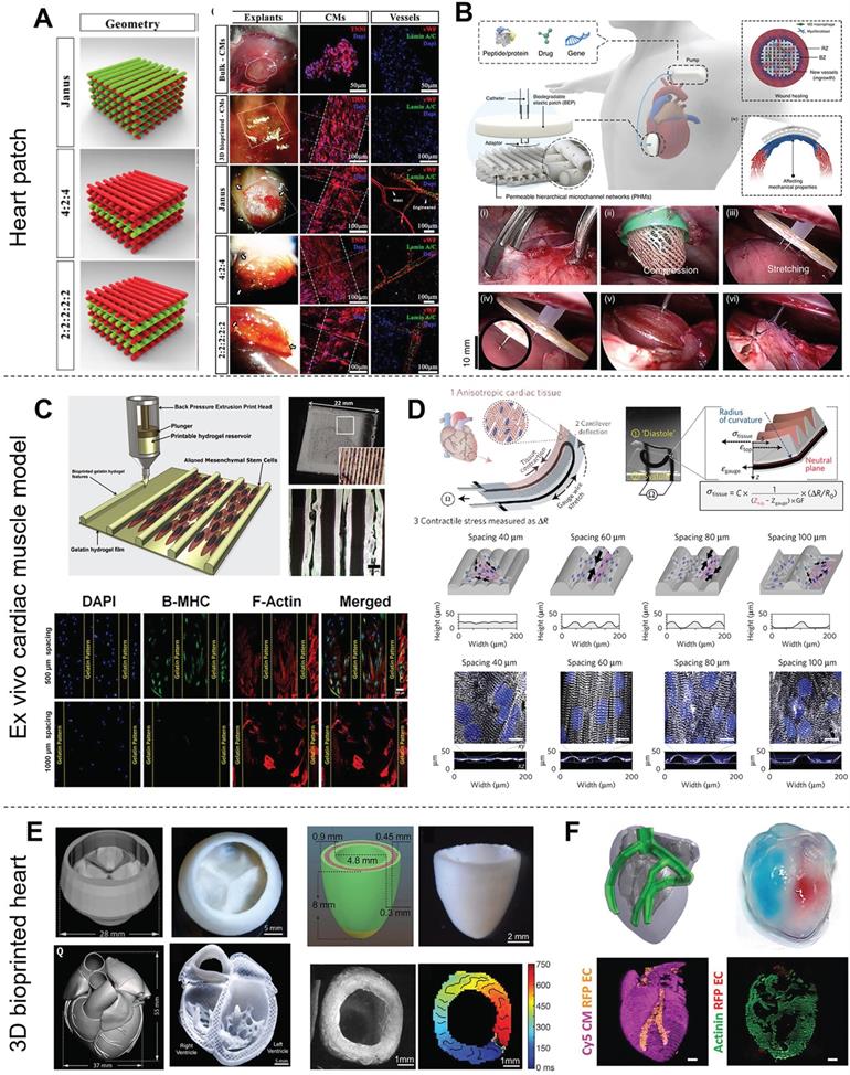 3D bioprinting in cardiac tissue engineering